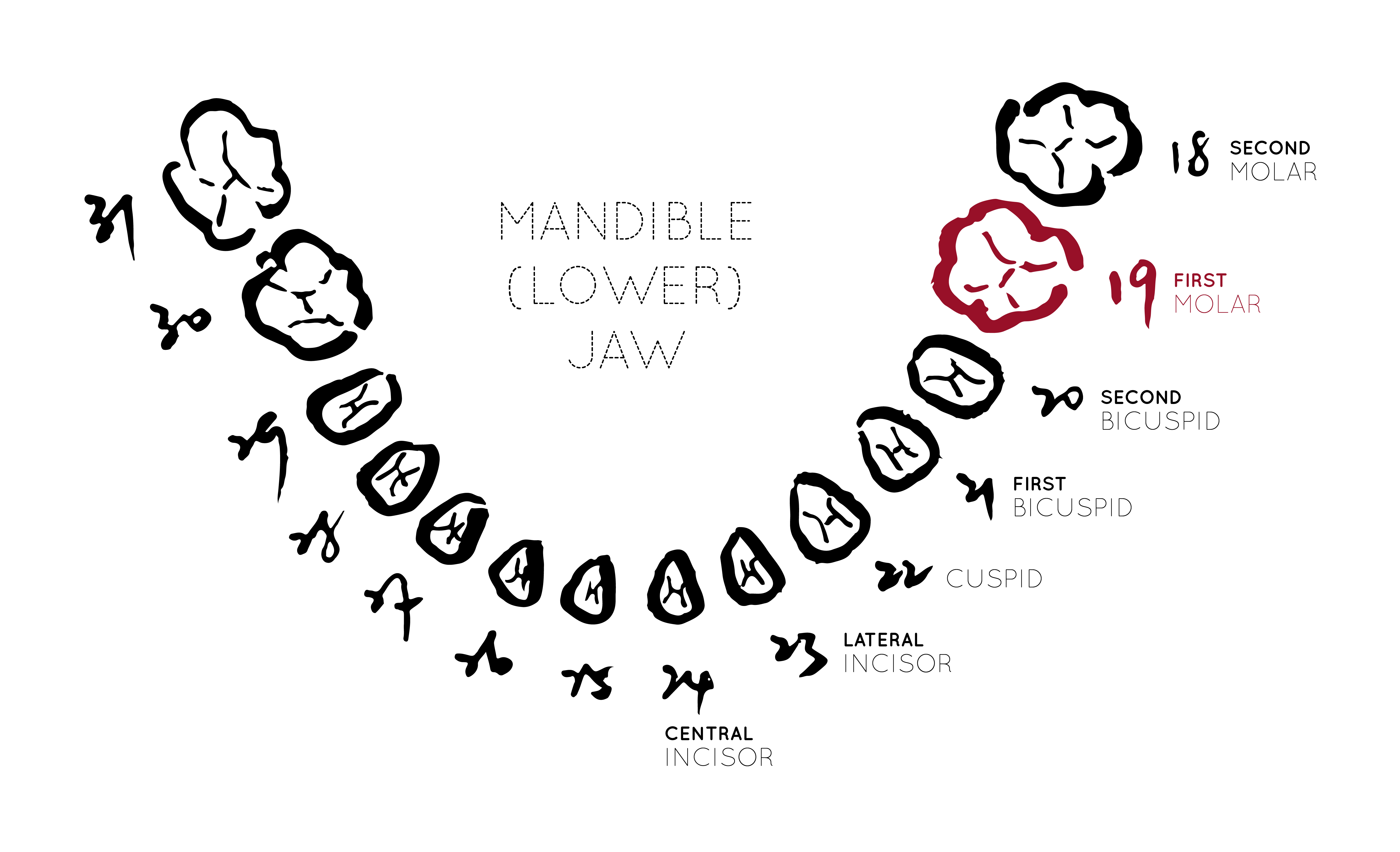 Goodbye, Tooth #19 (prepping for a tooth implant) – documenting